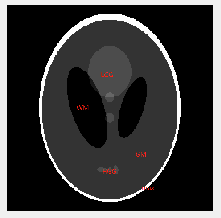 GitHub - jeferby/shepp_logan: this is a function to make simulated data in IVIM, and data is ...